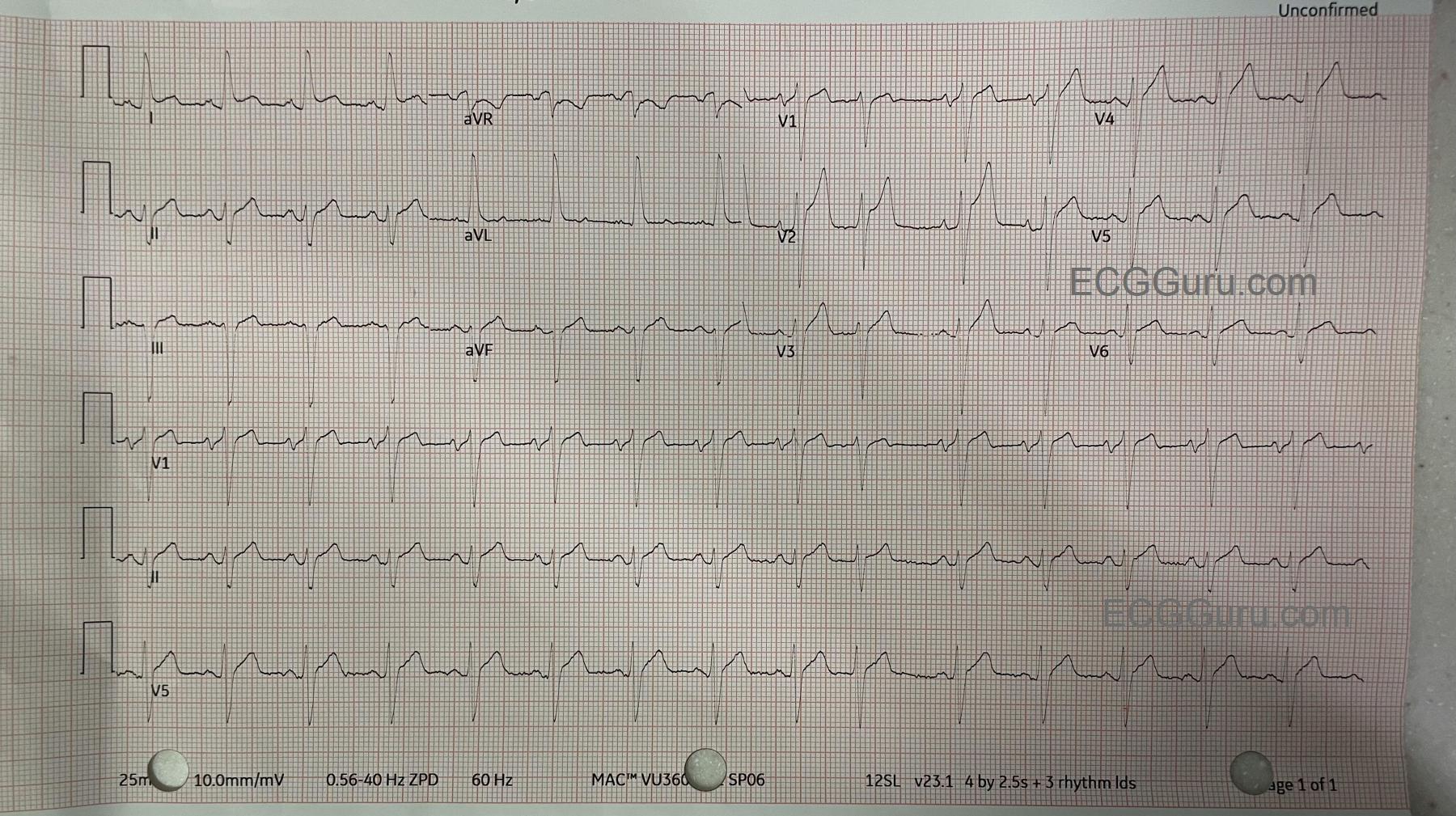 OMI | ECG Guru - Instructor Resources